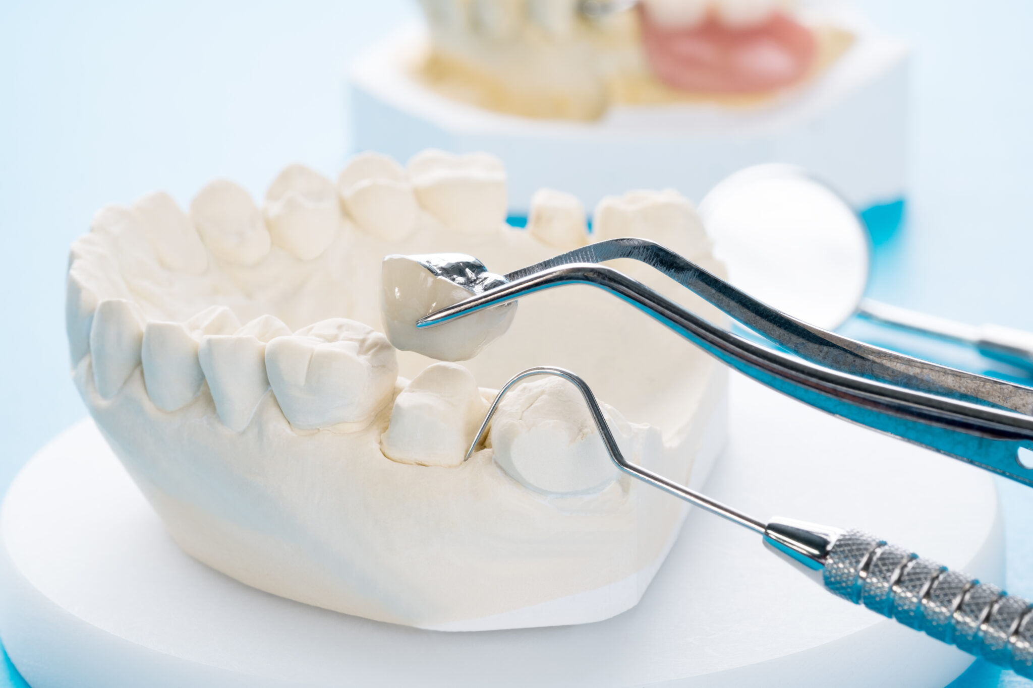 Tooth Sensitivity After Crown: What to Do? | Kiefer Family Dental
